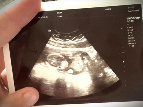 In Loving Memory of Infant Matthew Bratcher (Ryan) - Obituaries & Ways ...